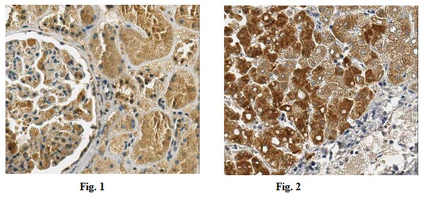 Anti-GPC3 Antibody, clone 9C2 | MABC667